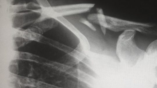 Rayos X en la clínica veterinaria: cuidados y prevención - Blog de CIM ...